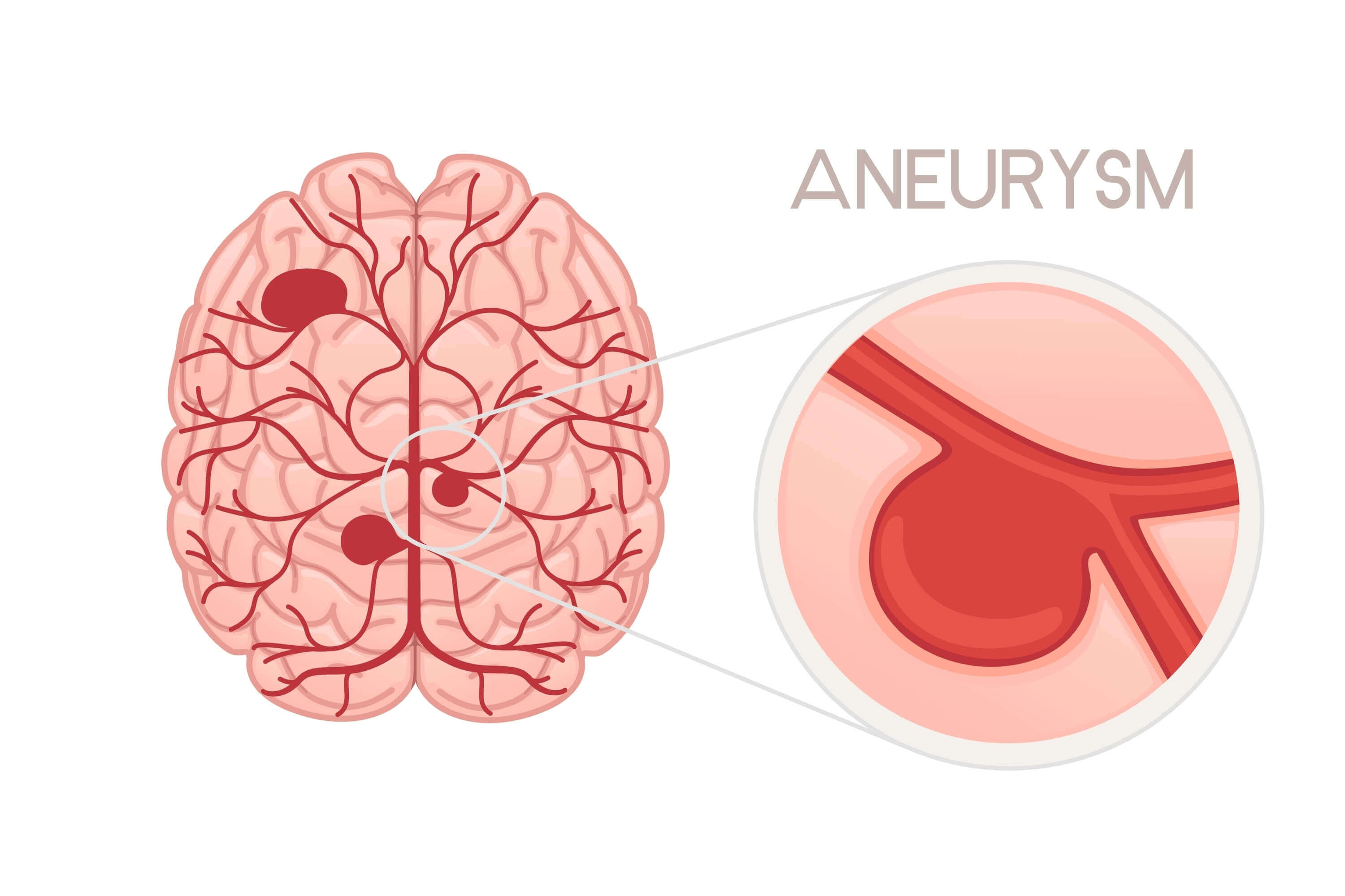 Conditions And Diseases Precision Neurosurgery
